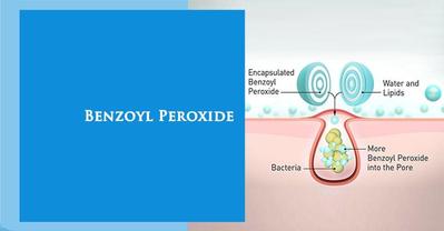 Khám phá Benzoyl Peroxide: Bí mật về "chiến binh" chống mụn bạn cần ...