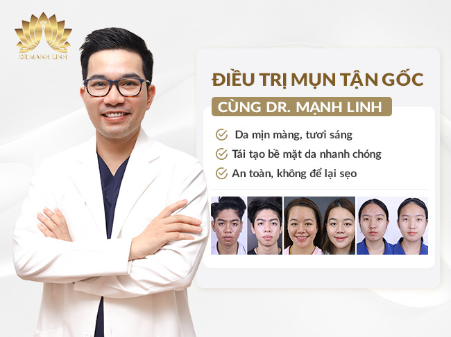 Top 11 Địa điểm Trị Mụn, Nặn Mụn An Toàn tại TP.HCM - Mytour.vn