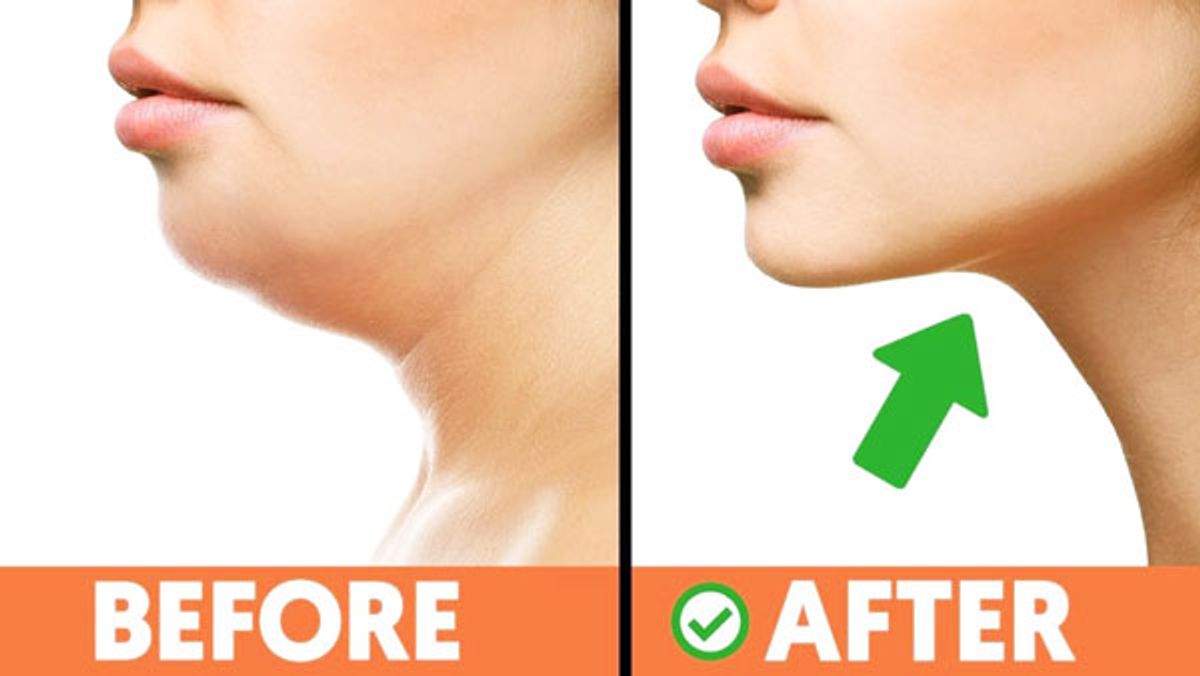 Effective Chin Slimming: 10 Exercises for a Sculpted Face | Mytour