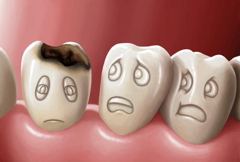 Effective Home Remedies for Treating Tooth Decay