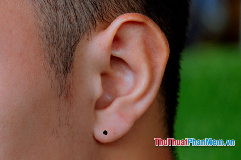 What does a mole on the ear mean? Good or bad?