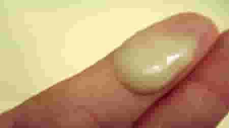 Clumpy yellow sperm could signal serious health risks or male ...