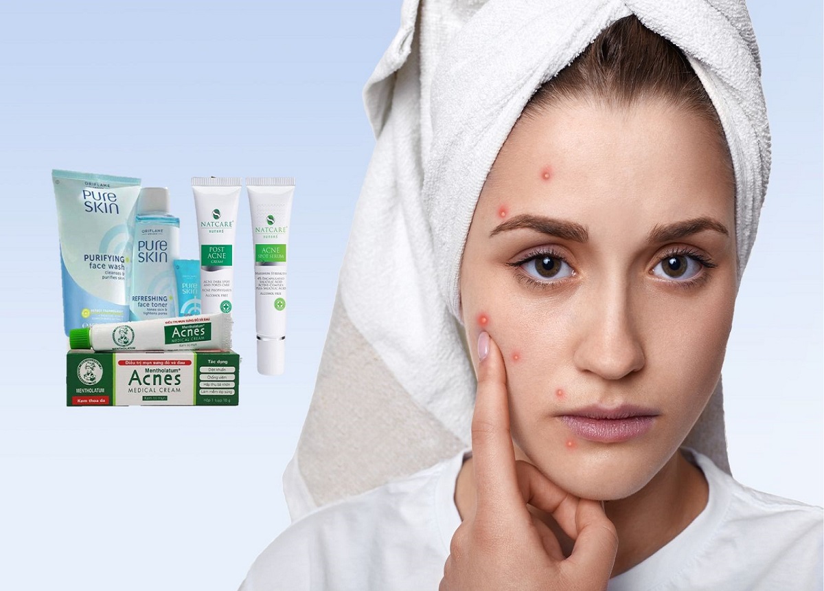 Discover the Fast and Effective Top 8 Acne Treatment Creams in Just a ...
