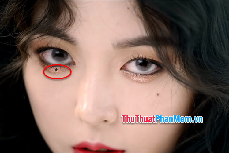 What Does a Mole under the Eye Mean? Is It Good or Bad? Should You ...