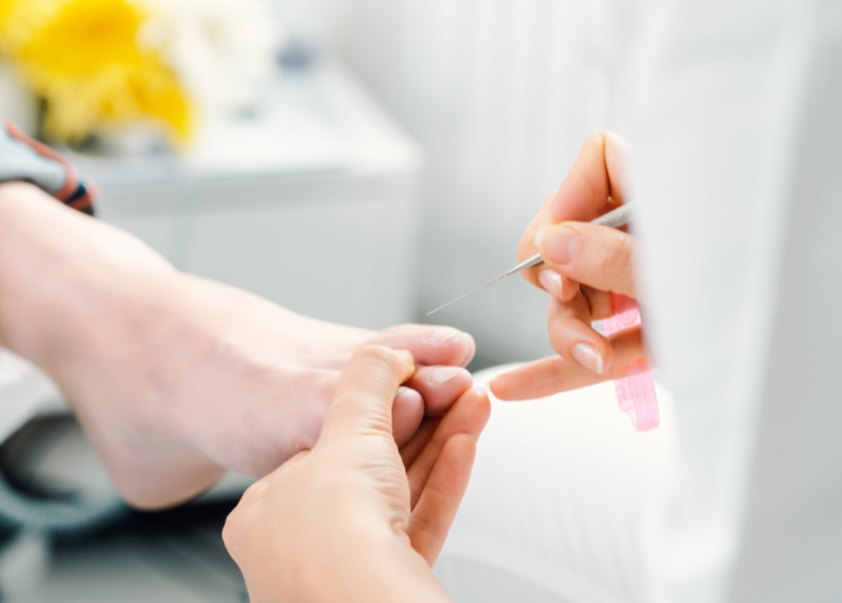 Proper Home Techniques for Pain-Free Toenail Corner Removal | Mytour