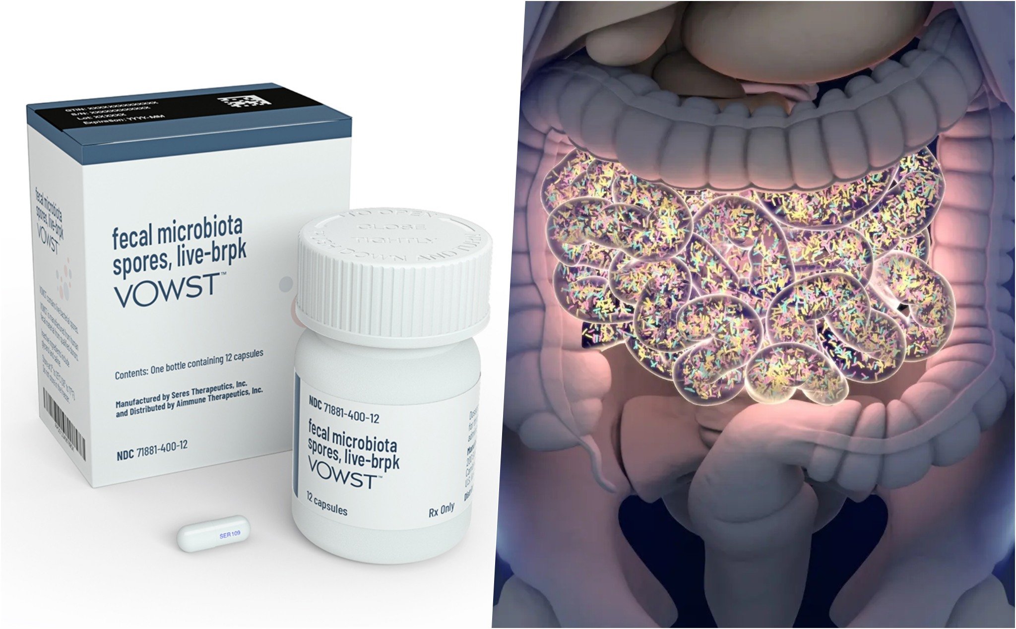 FDA chấp thuận việc sử dụng thuốc từ phân người để chữa trị nhiễm trùng ...