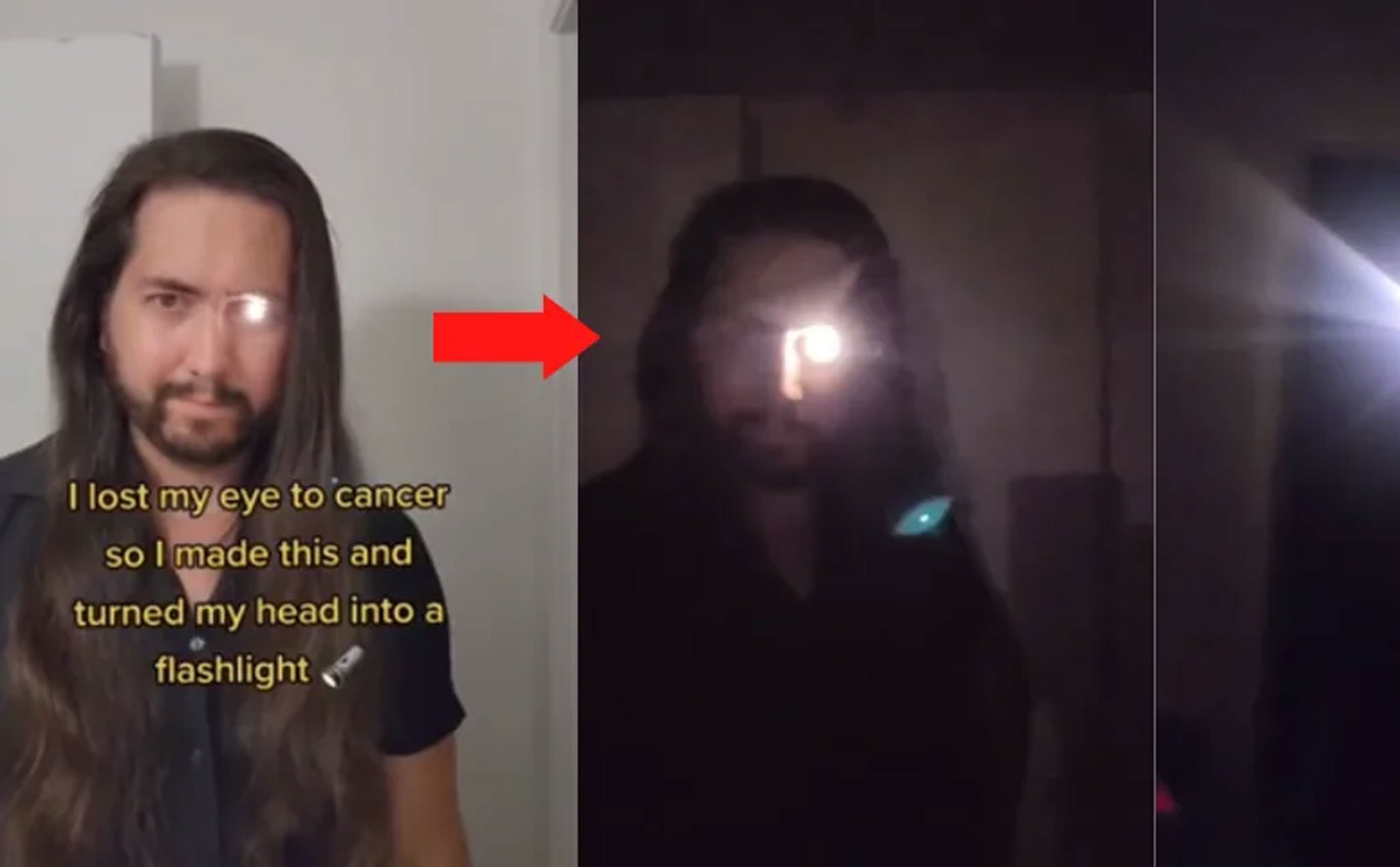 Một người đàn ông đã biến mất mắt phải của mình thành một chiếc đèn pin như trong phim