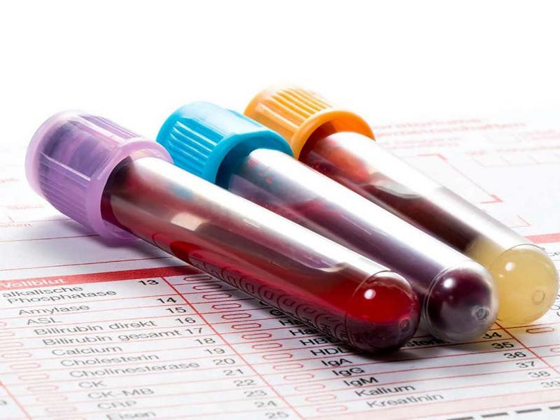 Top 11 Trusted and Quality Blood Testing Centers in Ho Chi Minh City ...