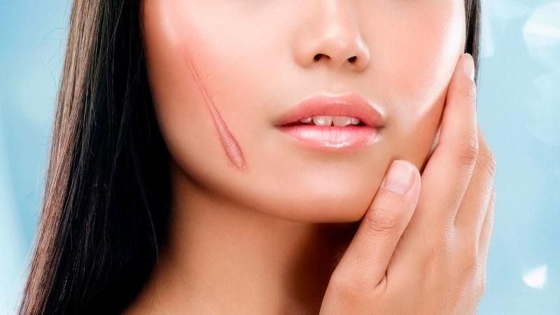 Explore the Top 5 Best Japanese Scar Treatment Creams