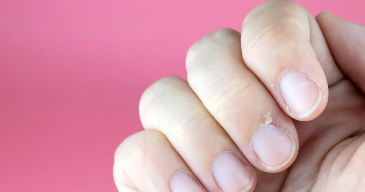 Causes and Treatment of Nail Cuticle Scratching | Mytour