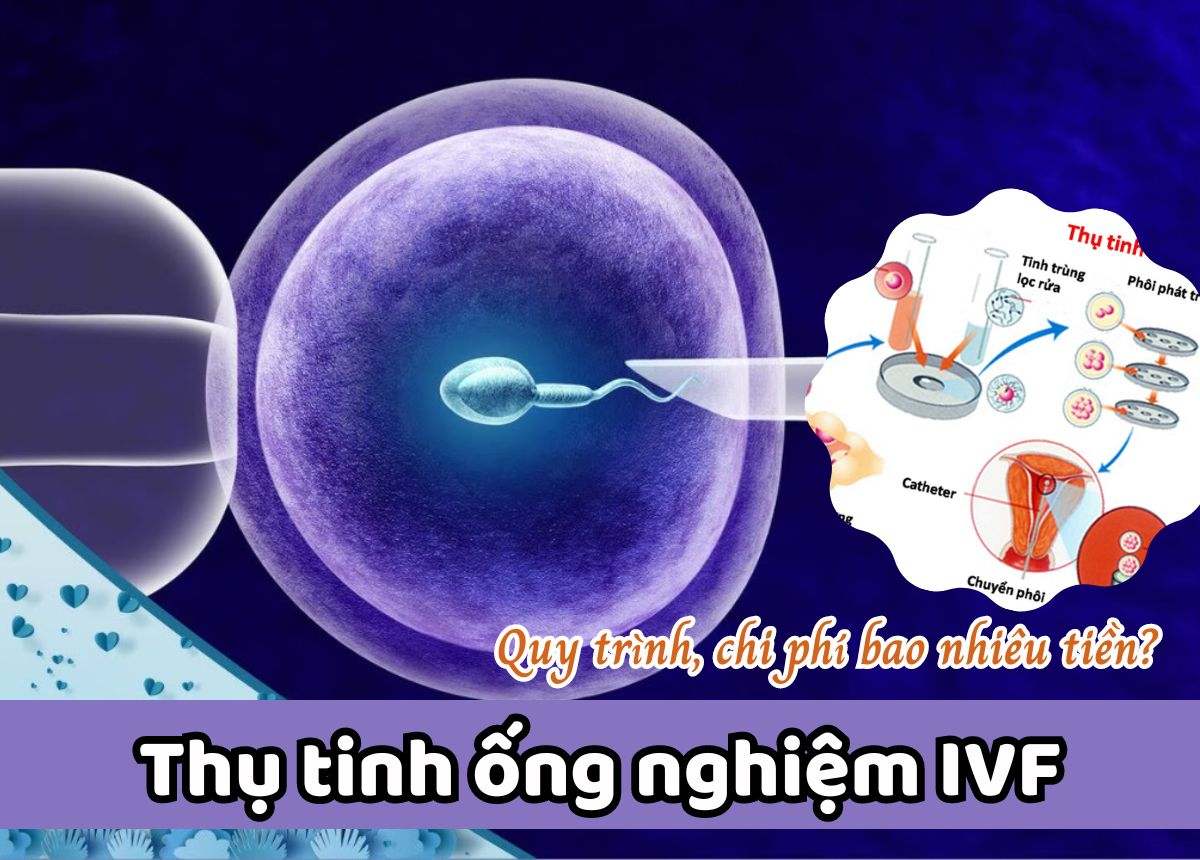 What is IVF? Procedure and Costs | Mytour