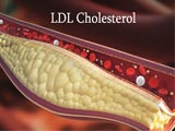 Understanding LDL Cholesterol: Risks and Benefits