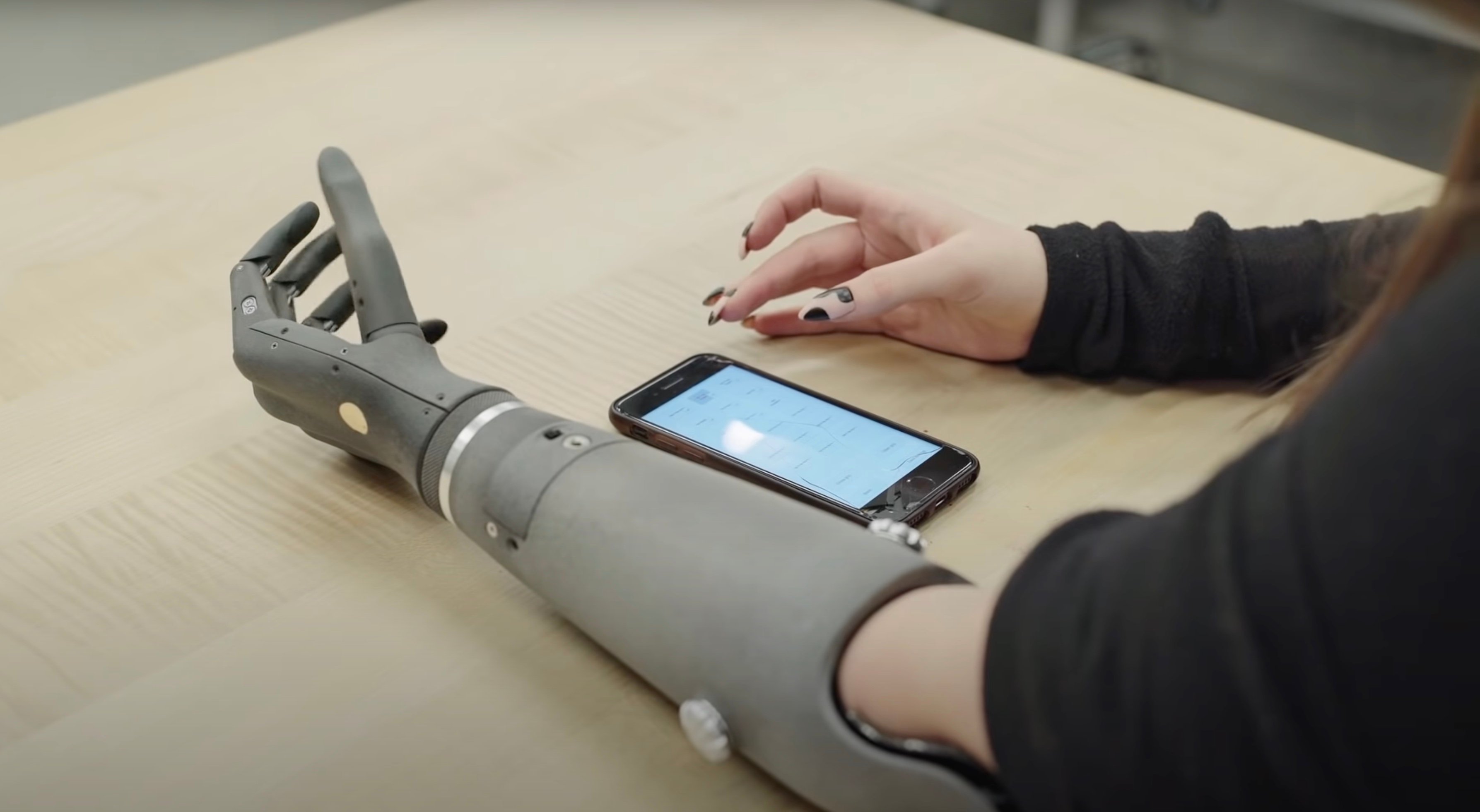 Tại sao tay chân robot cho người khuyết tật vẫn chưa phổ biến mặc dù ...