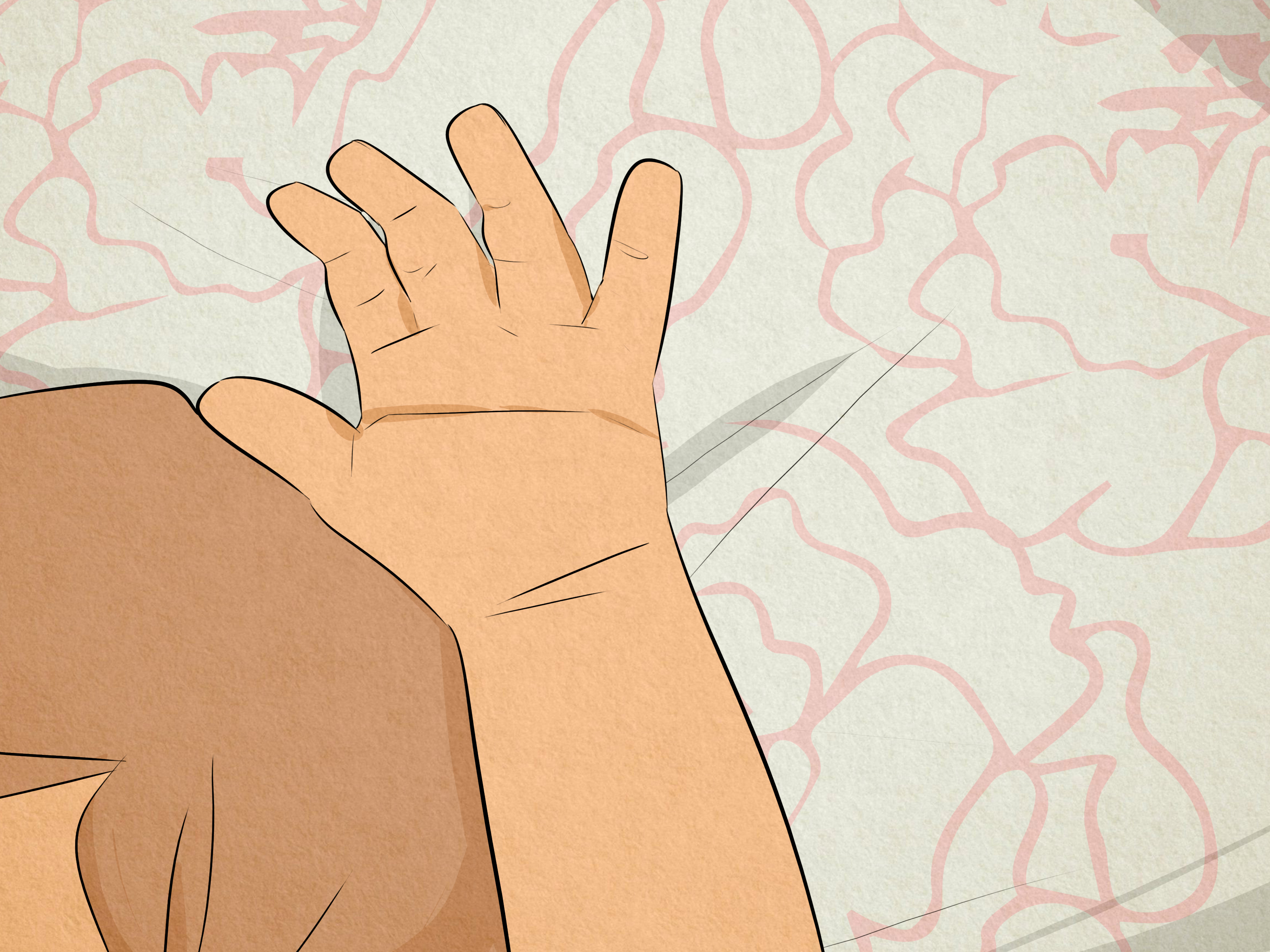 Đường Simian: Palmistry và Ý nghĩa Y học