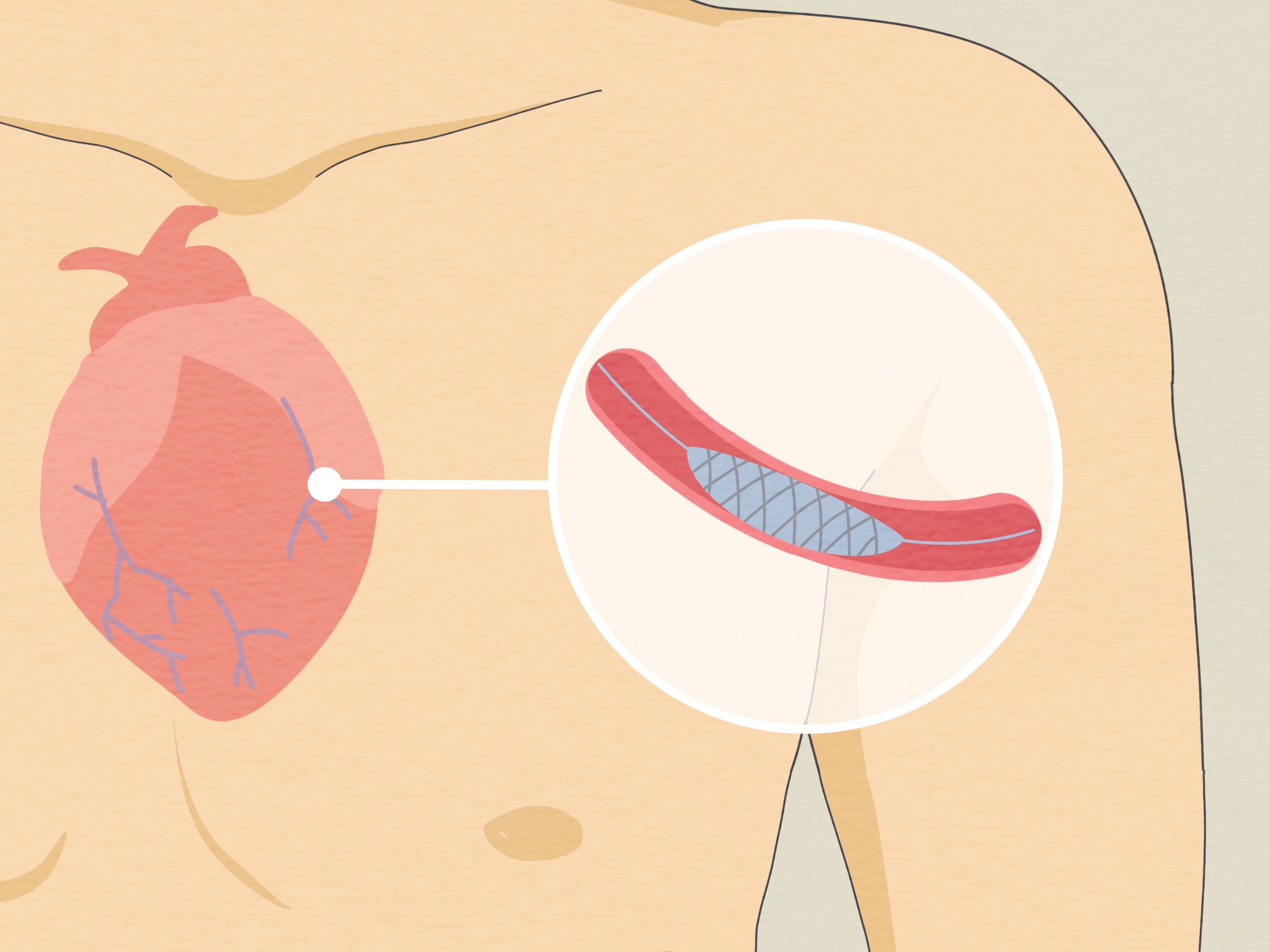 Deciphering Left Arm Pain: Understanding 9 Heart-Related Causes