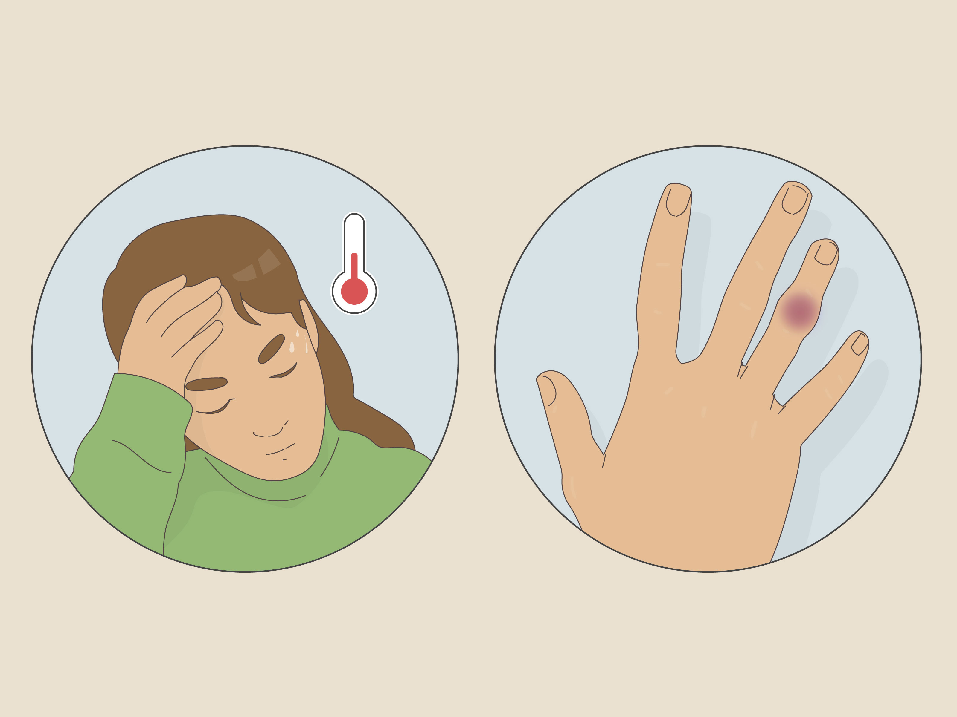 13 Strategies to Ease the Pain of Jamming Your Finger in a Door