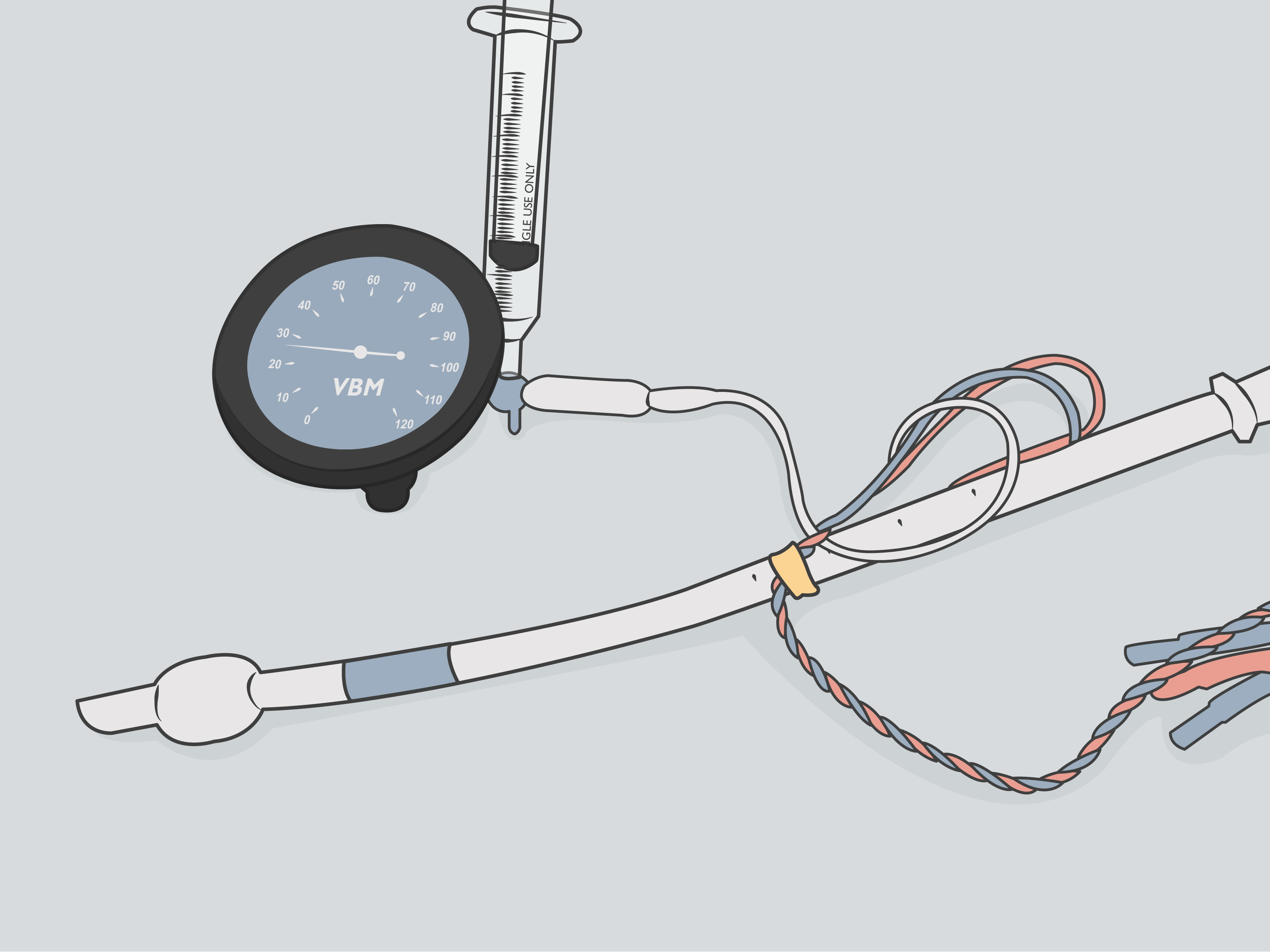 How to Measure an ET Tube in 14 Steps