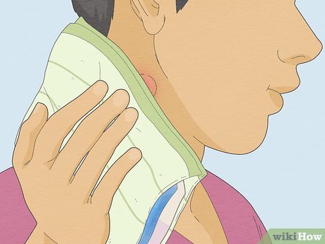 Effective Ways to Reduce Swollen Lymph Nodes: A Comprehensive Guide