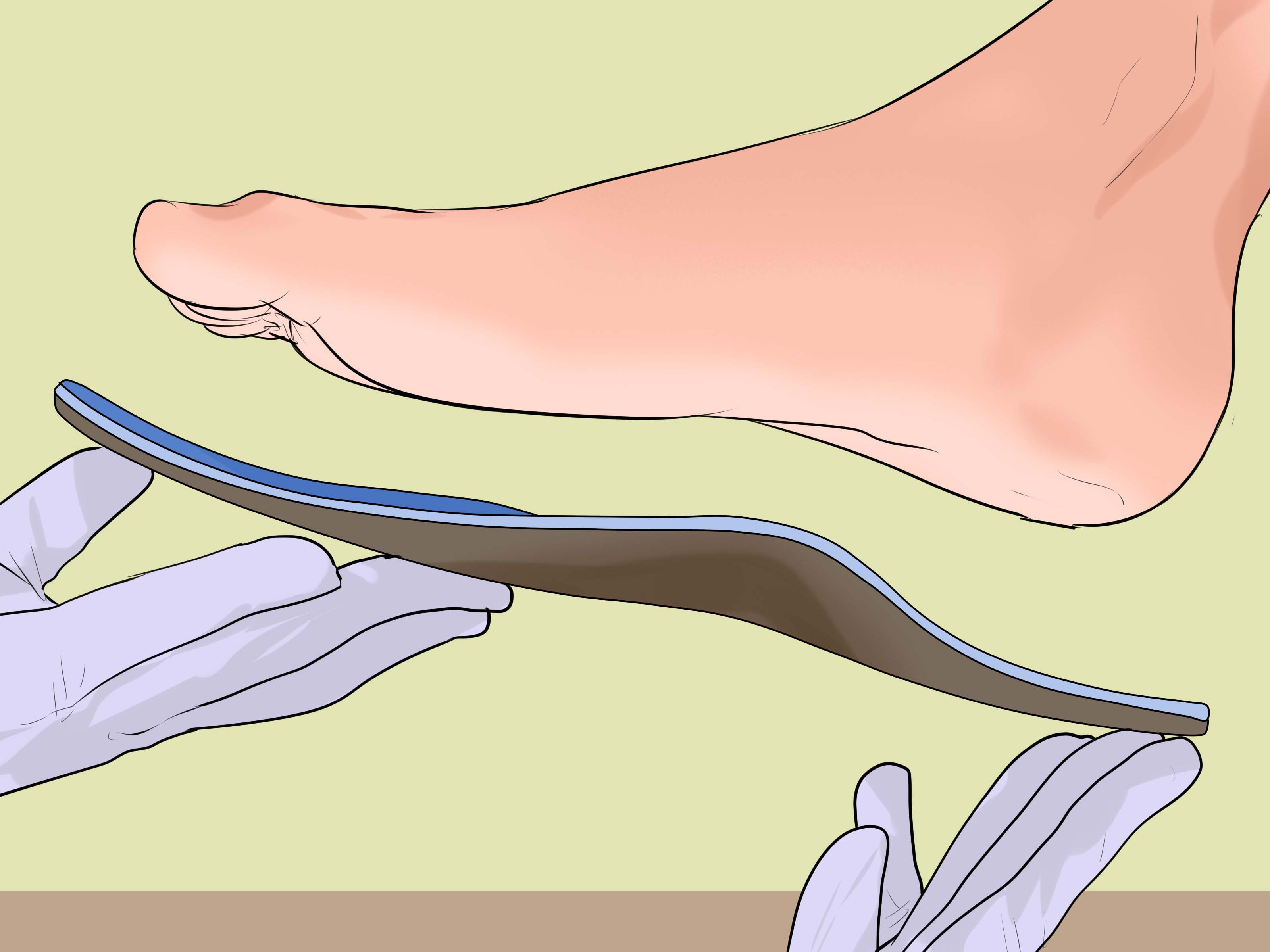 How to Correct a 'V-Shaped' Walking Style to a Straight Style