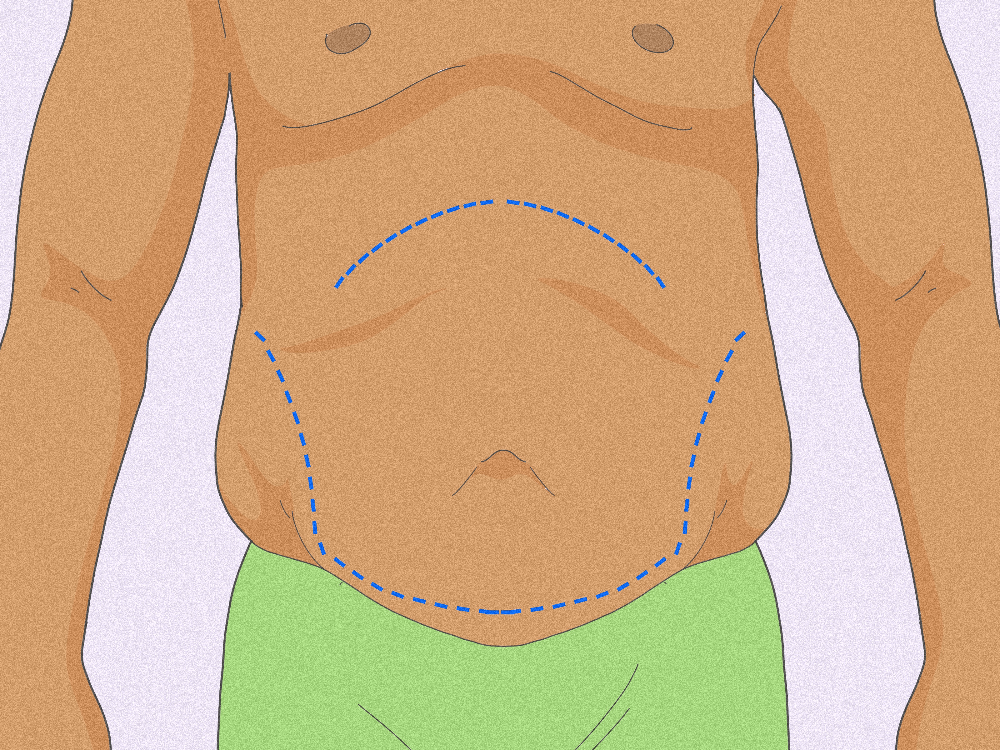 Natural and Cosmetic Methods to Remove Excess Skin