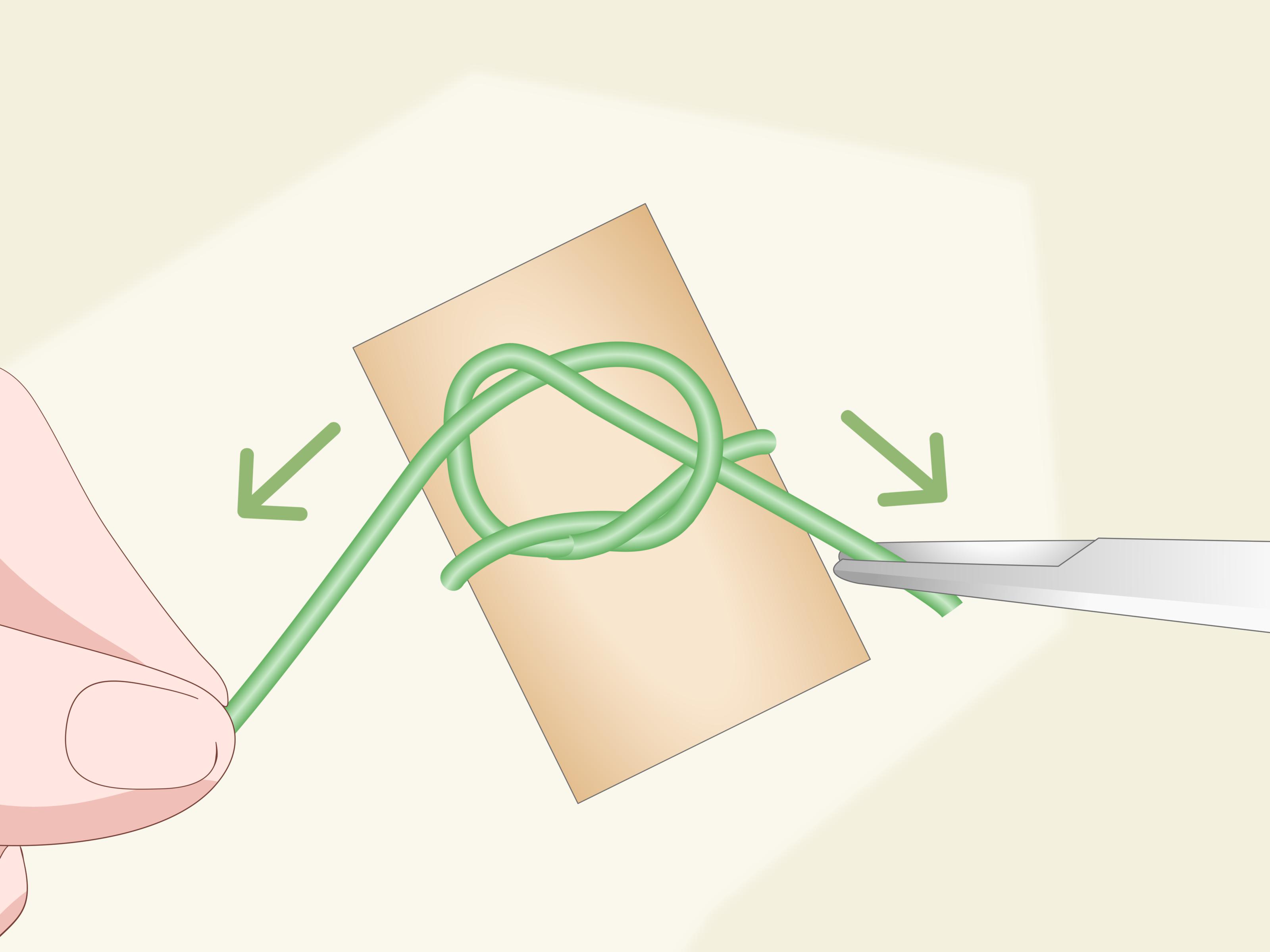 3 Simple Techniques for Tying Surgical Knots - Mytour