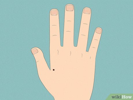 Understanding the Significance of Hand Moles: Interpretation ...