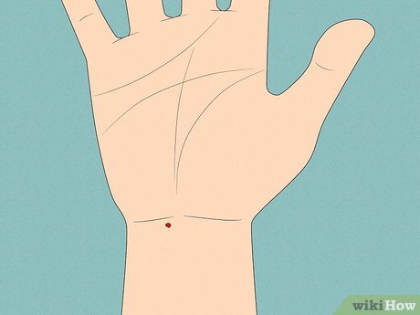 Understanding the Significance of Hand Moles: Interpretation ...