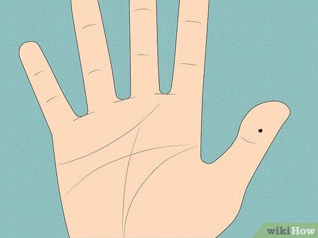 Understanding the Significance of Hand Moles: Interpretation ...