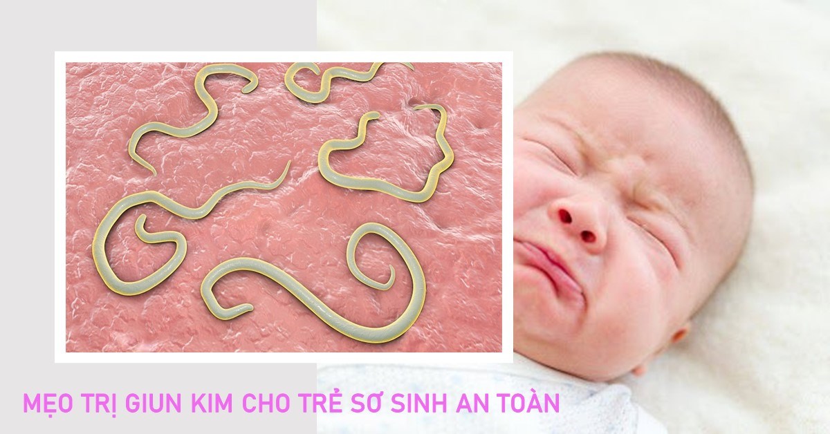 Bí quyết trị giun kim ở trẻ nhỏ an toàn cho các bậc phụ huynh