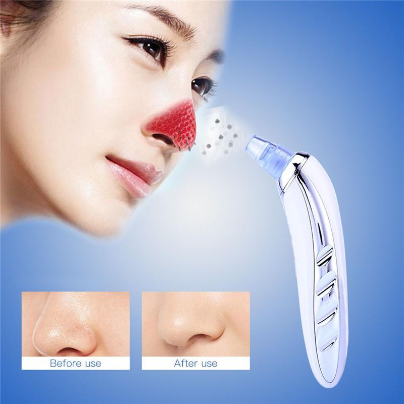 Top 11 Effective and Safe Handheld Blackhead Removal Machines You ...