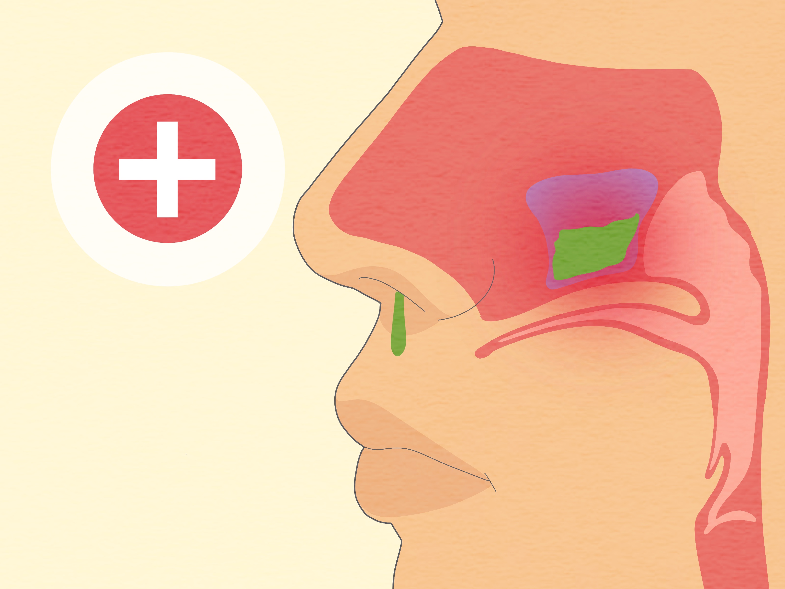 How to Treat Inner Ear Infections or Eustachian Tube Blockage: 14 Steps ...
