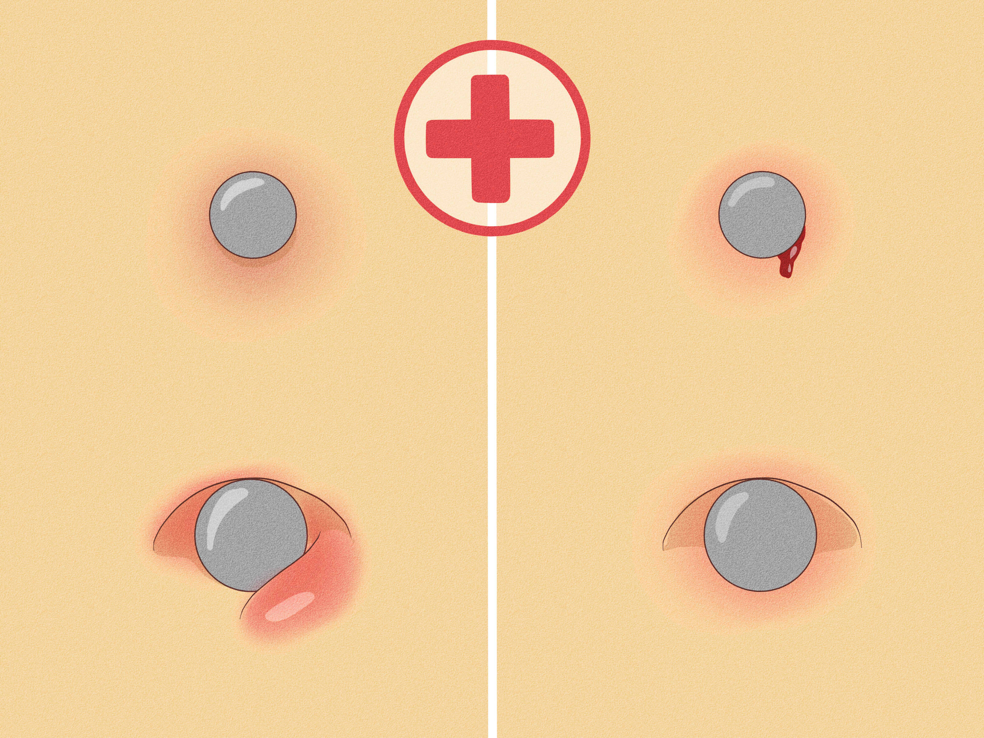 How to Take Care of Your Belly Button After Piercing (with Images) – Mytour