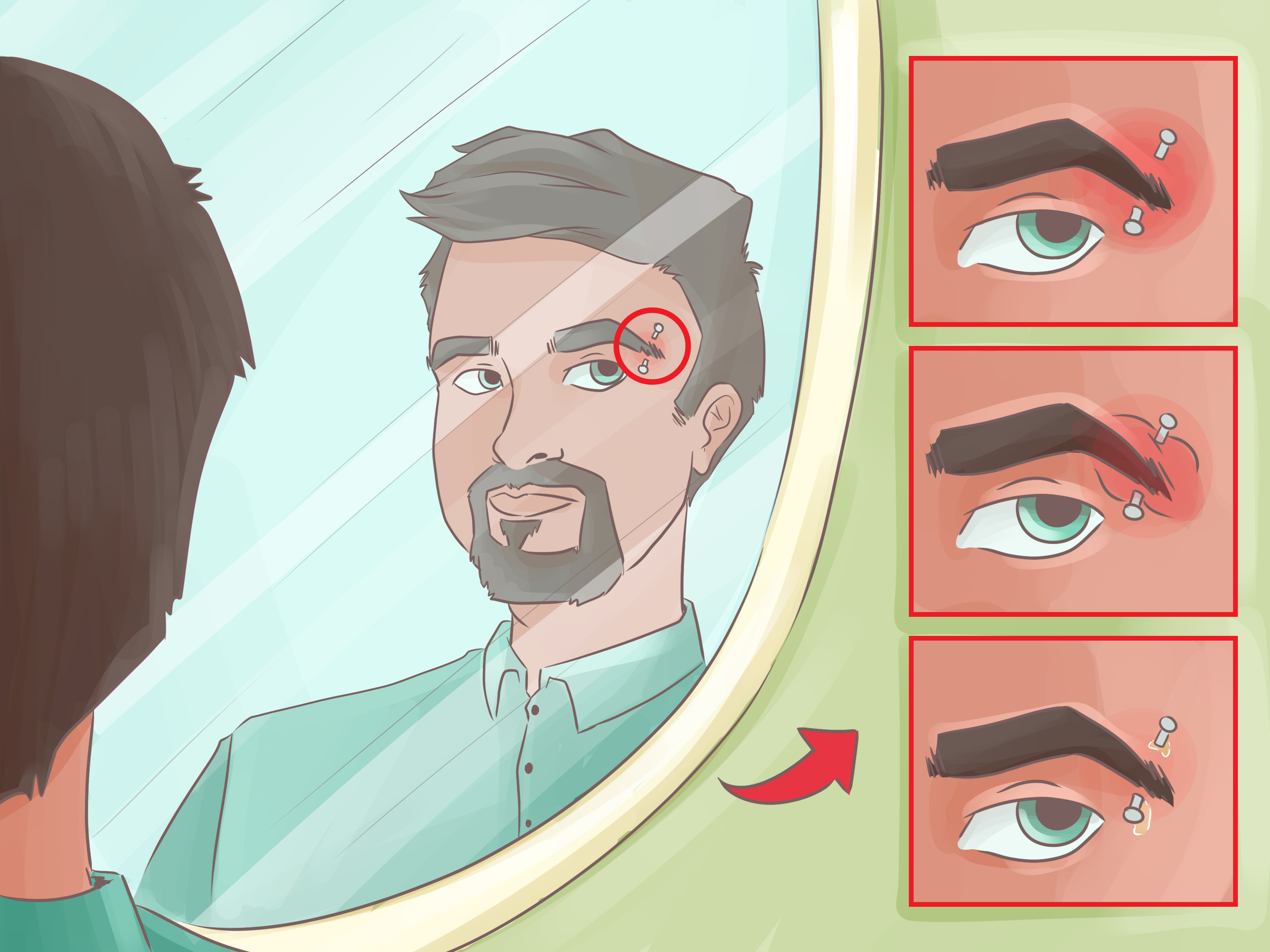 Quick Healing for Pierced Holes – Mytour