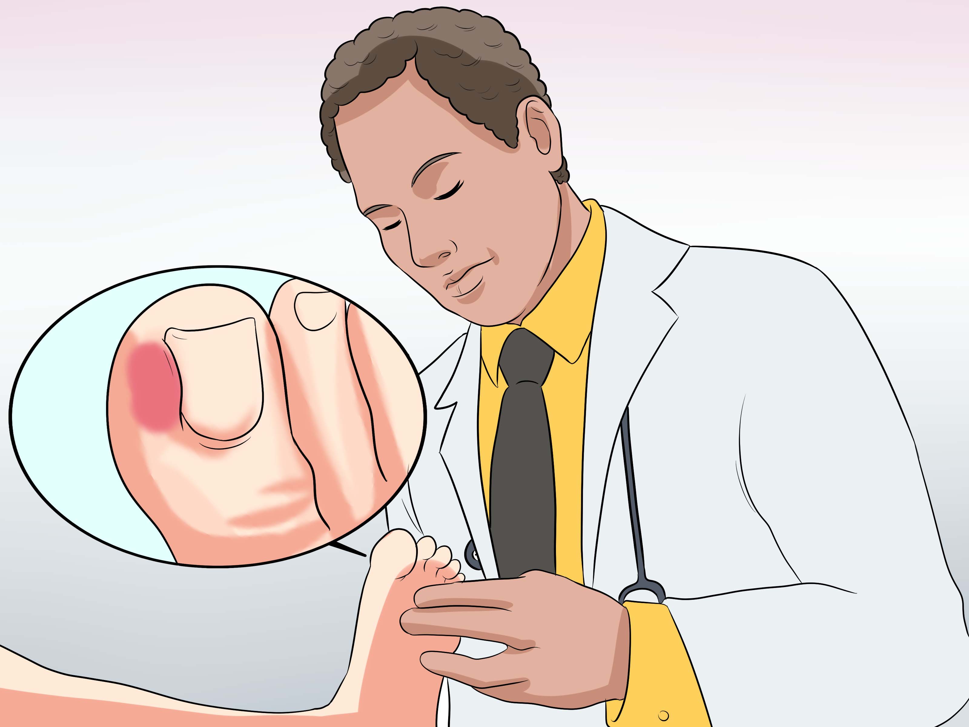 How to treat an infected toe – Mytour
