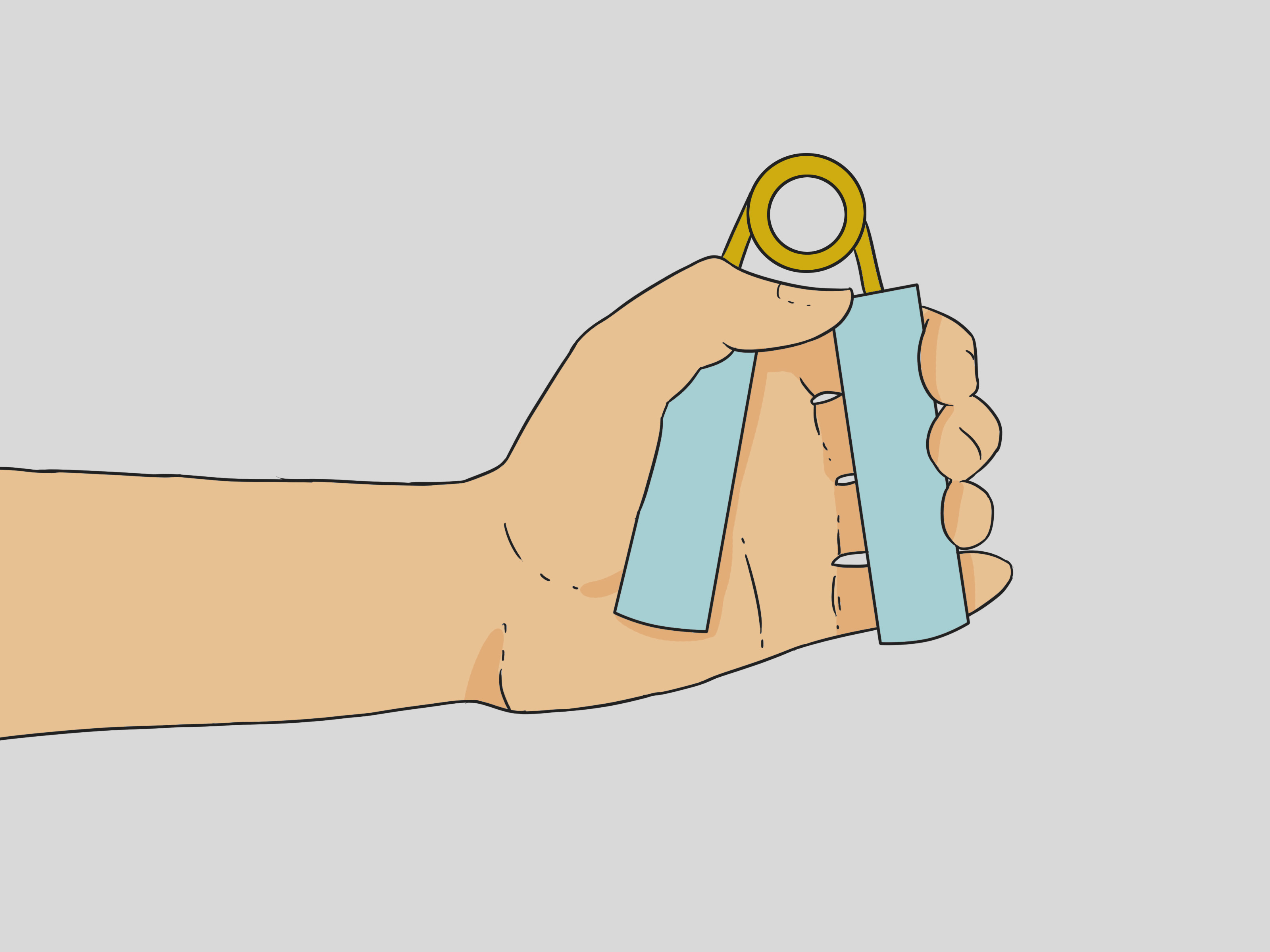 How to Diagnose a Thumb Fracture: 15 Steps (with Photos) – Mytour