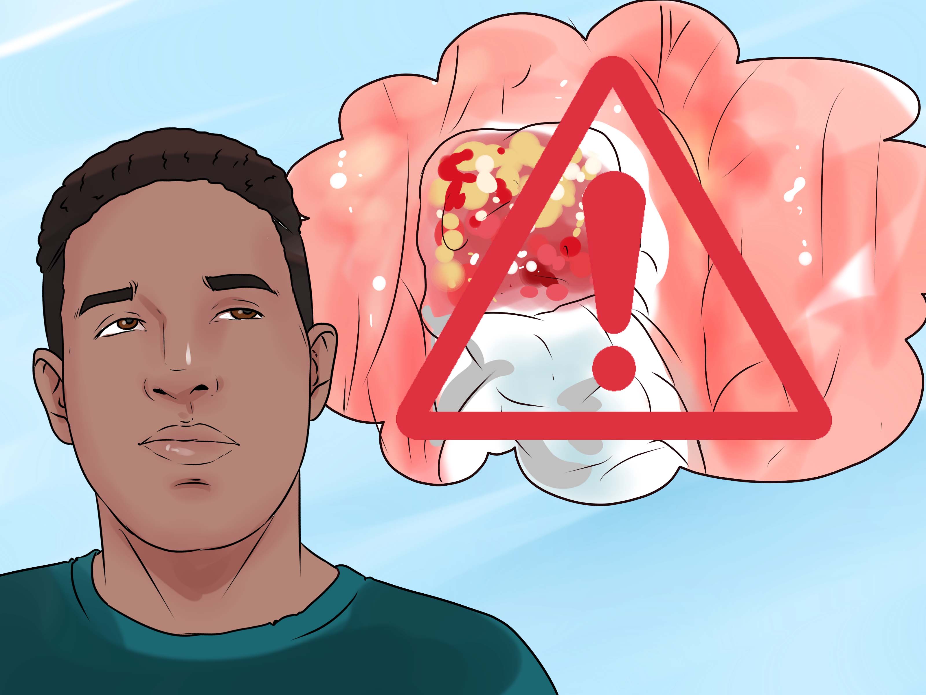 How to Remove Food Particles from a Recently Extracted Wisdom Tooth ...