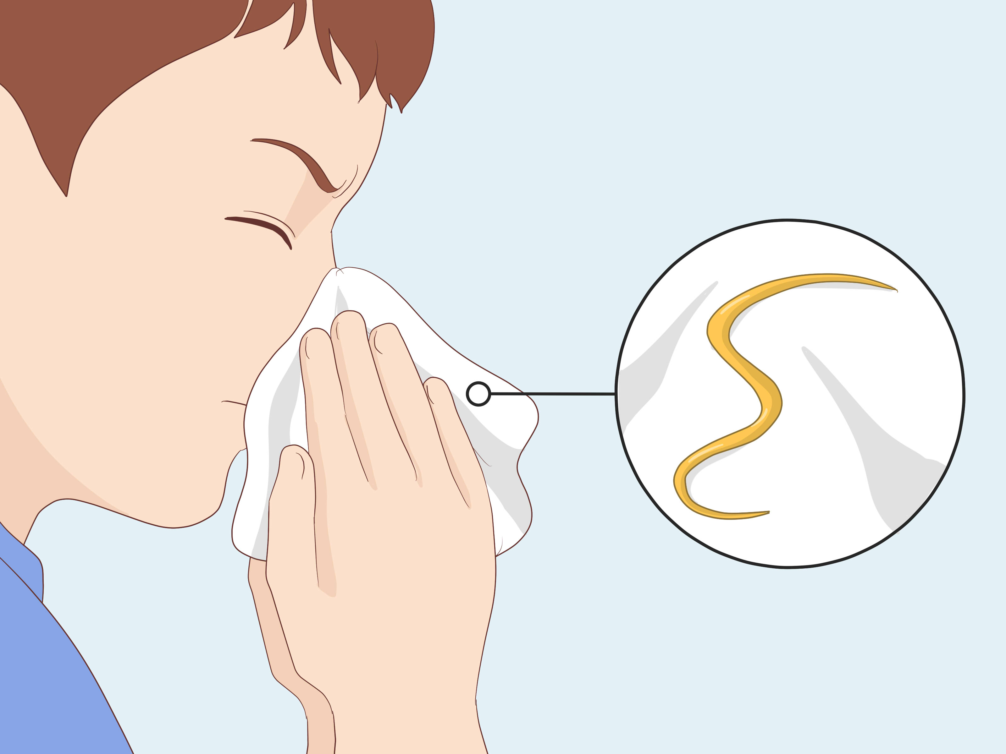 Identifying the Signs of Worm Infections – Mytour