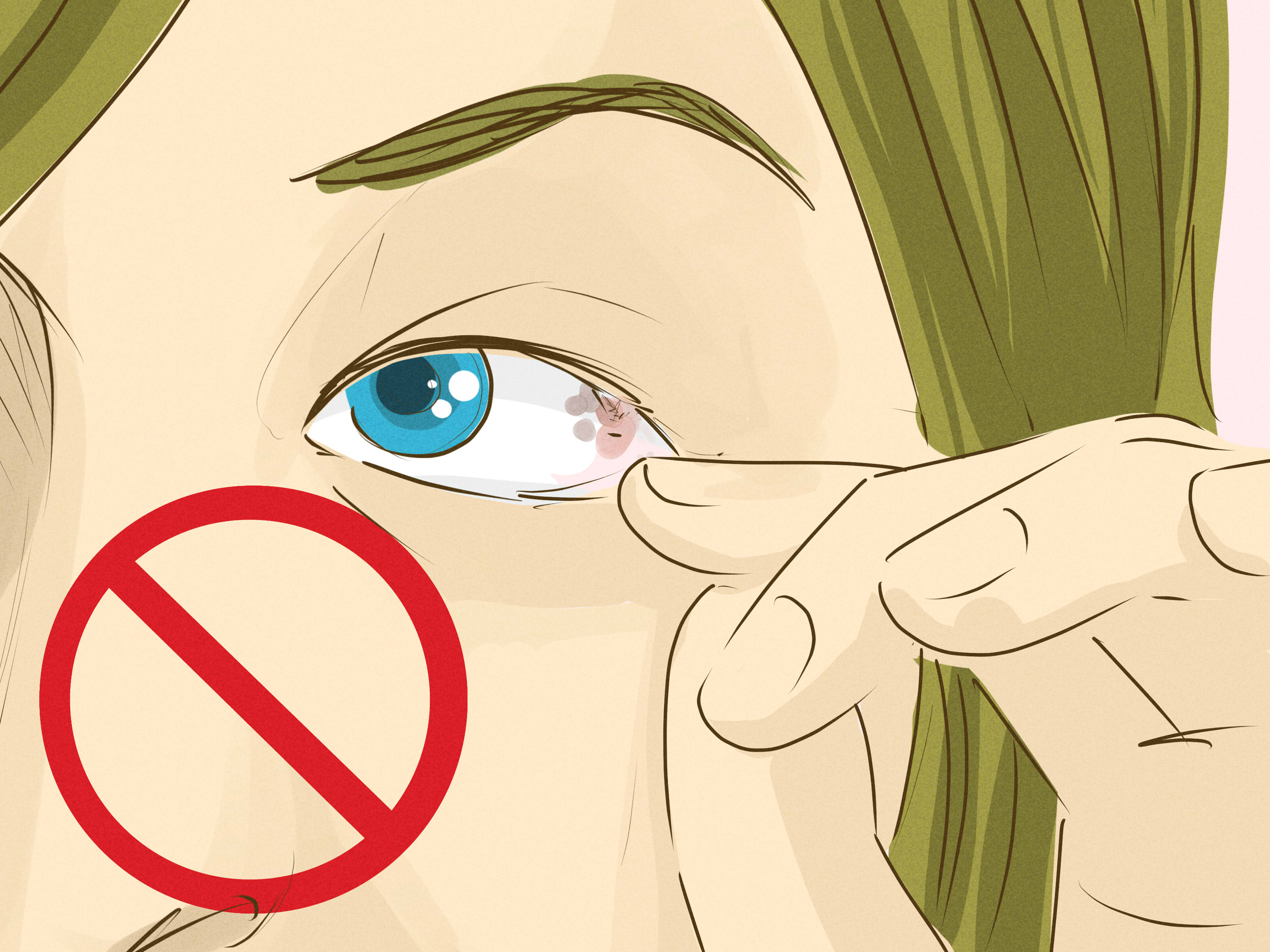 How to Remove Foreign Objects from Your Eye – Mytour