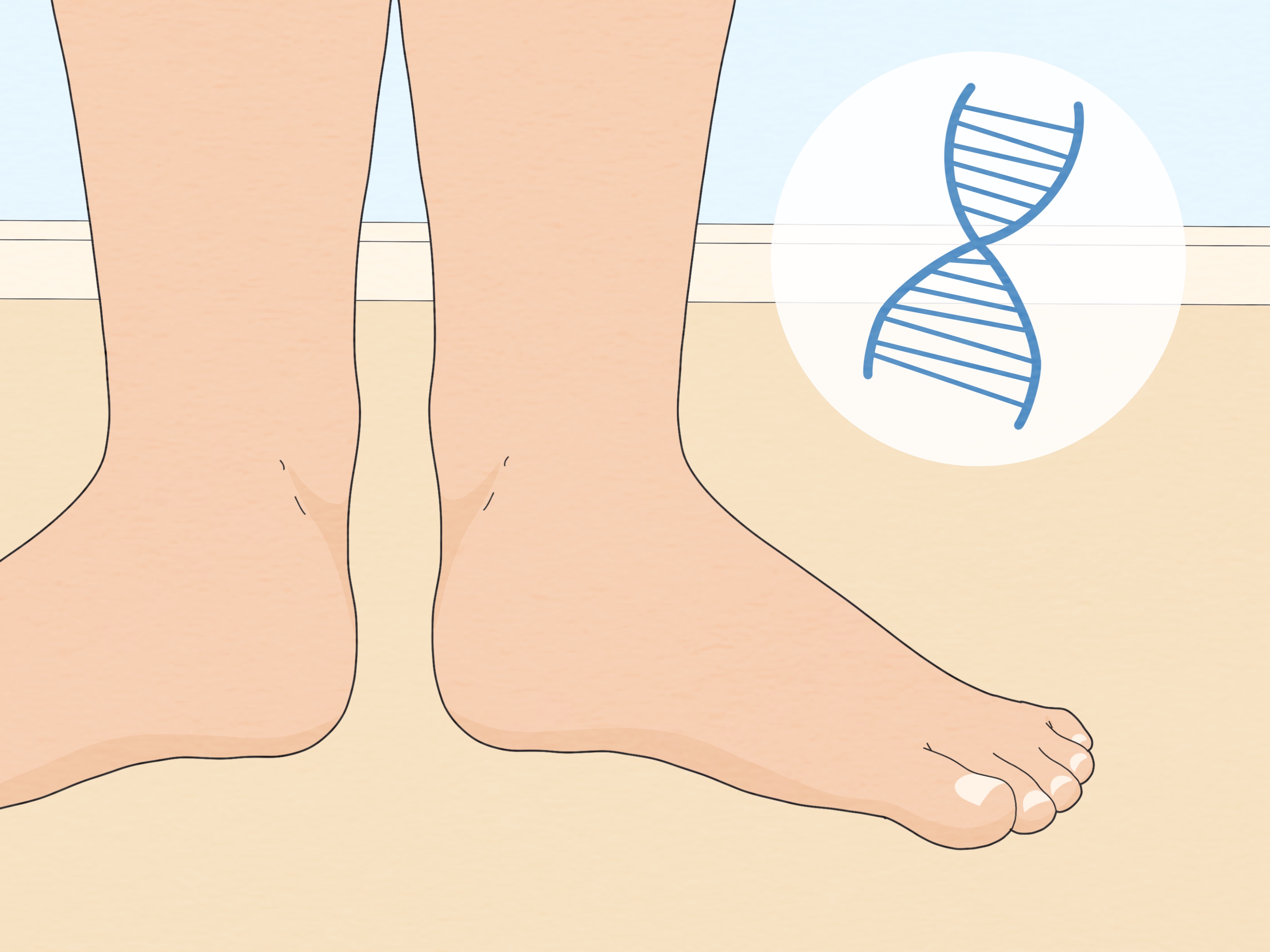Treatment for outward foot turning in adults – Mytour