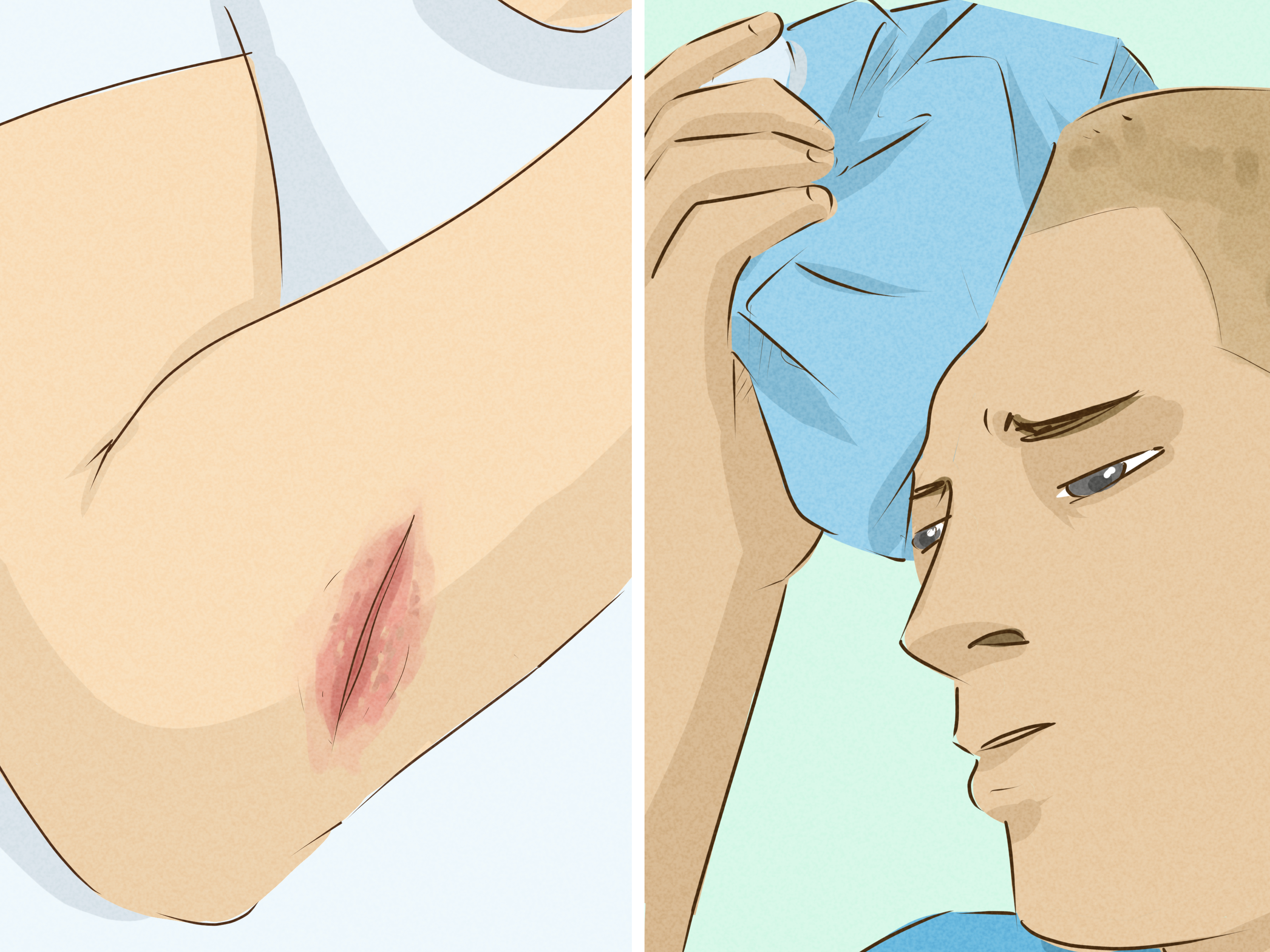 How to Heal Cuts Quickly Using Natural and Easy-to-Find Materials