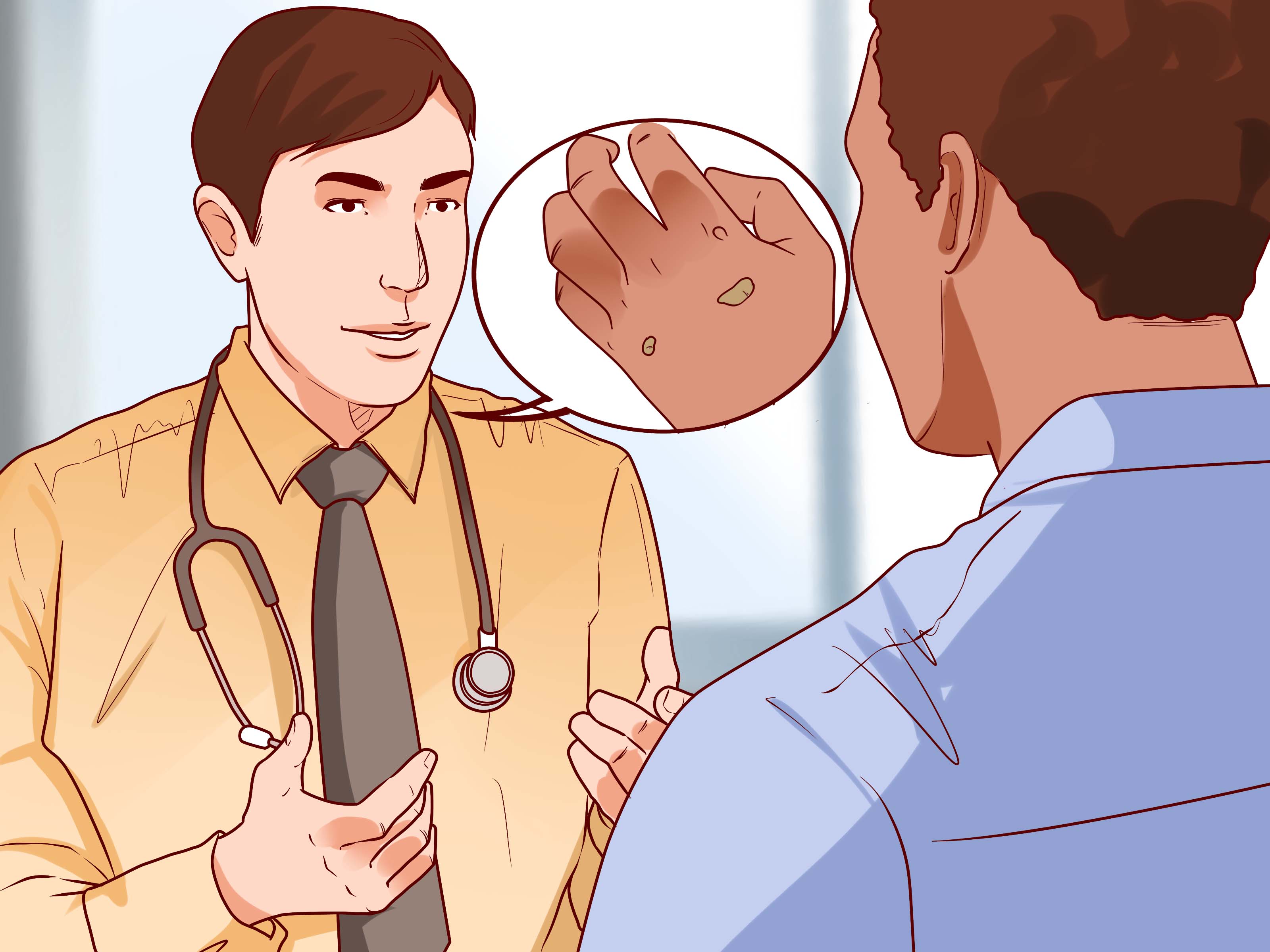 Natural treatment for warts with garlic – Mytour
