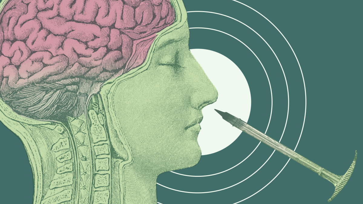 Everything You Didn’t Know You Needed to Know About Lobotomies | Mytour