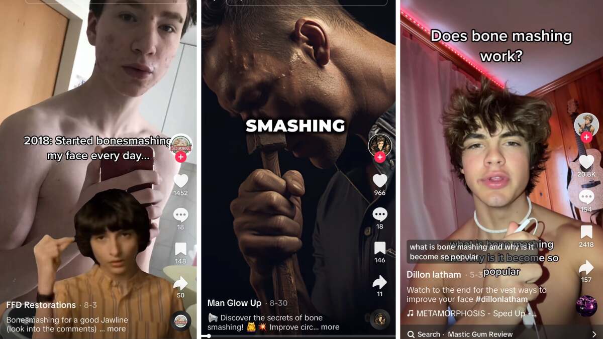 ‘Bone Smashing’ Promises Beauty: The Latest TikTok Trend | Mytour