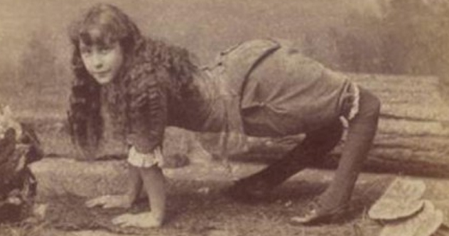 10 Astonishing Physical Abnormalities That Will Leave You Stunned - Mytour