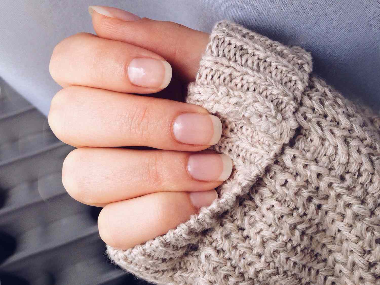 Expert Insights on Identifying Unhealthy Nails