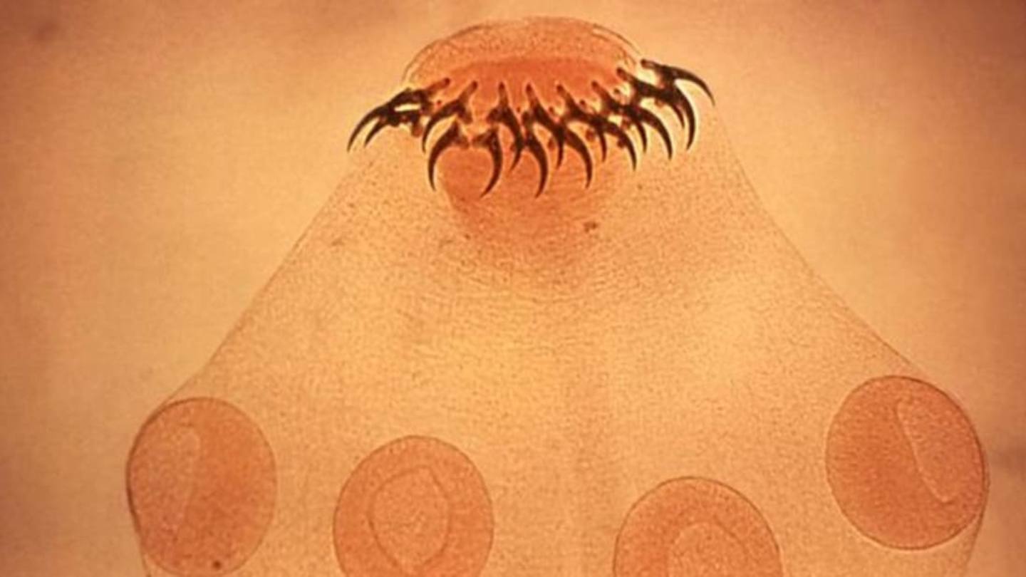 14 Unexpected Facts About Tapeworms