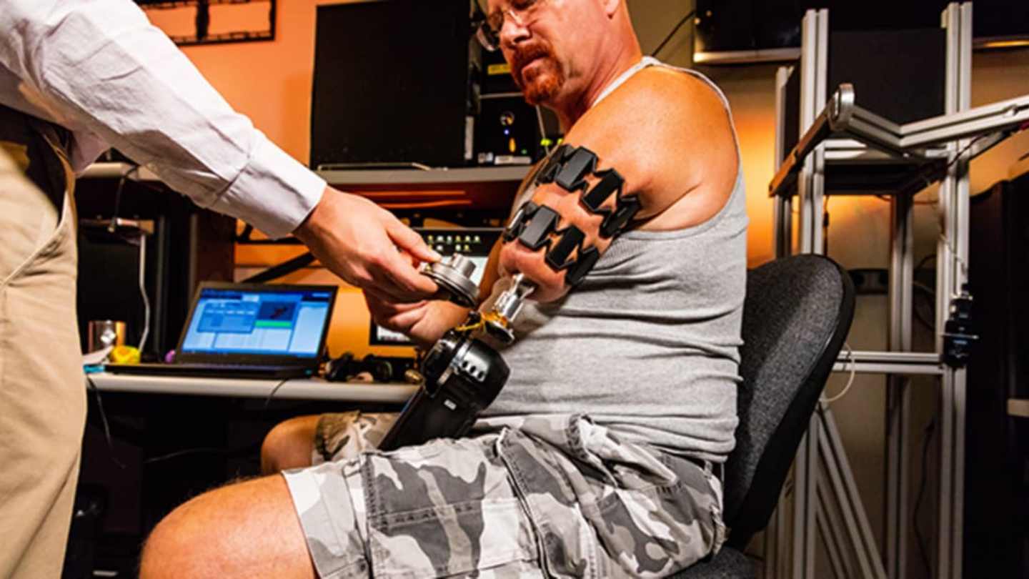 Mind-Controlled Prosthetic Arm Offers Revolutionary Control