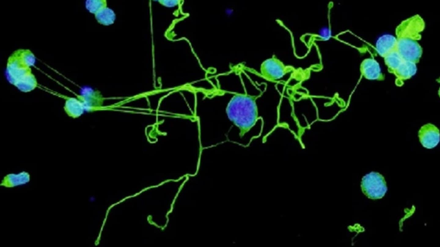 Biosilk-Based 3D Bone Marrow Model Successfully Produces Blood Platelets