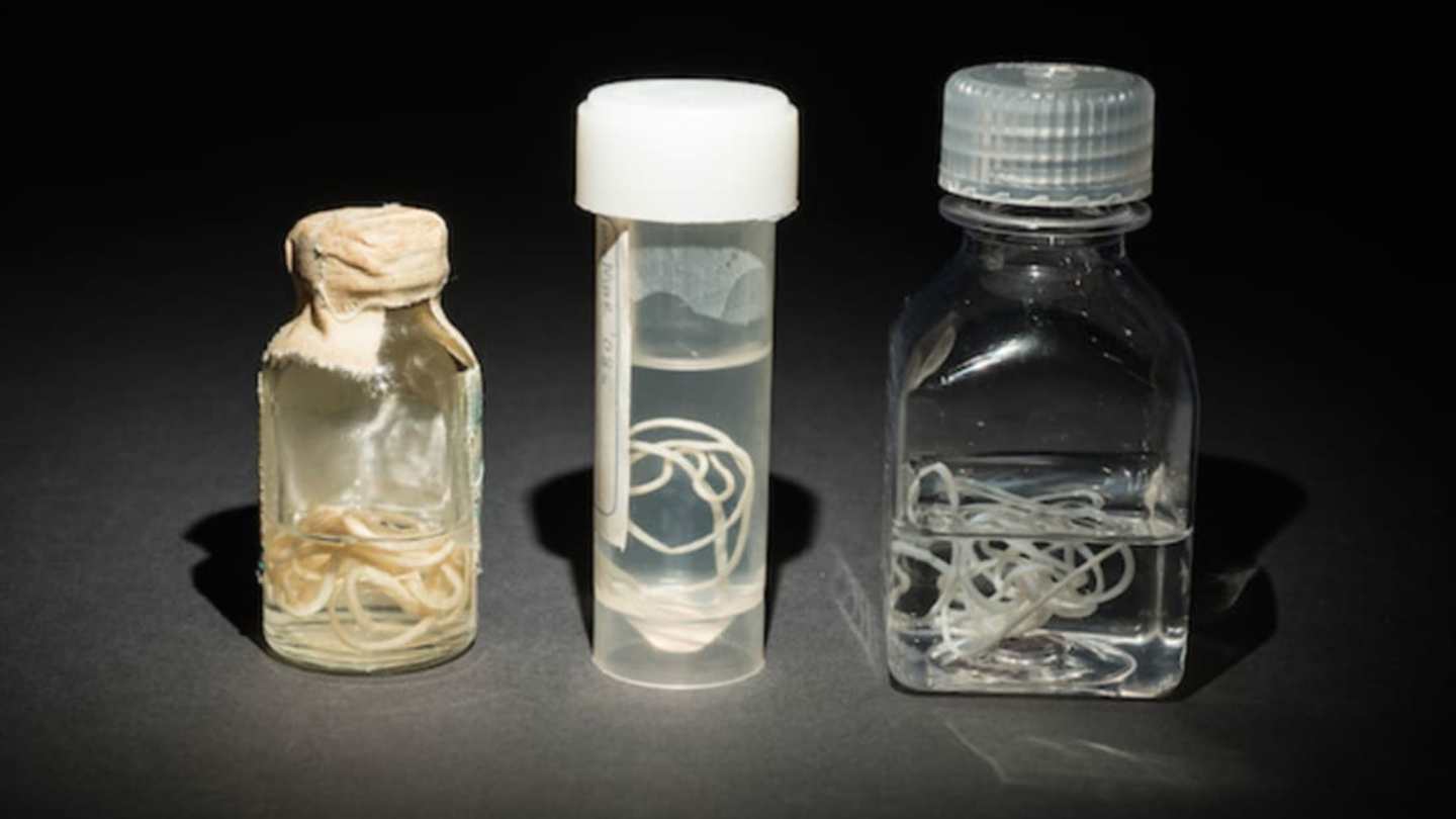 10 Essential Insights into Guinea Worm Disease
