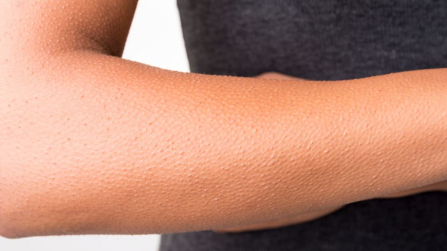 6 Astonishing Instances of Vestigial Traits in Humans